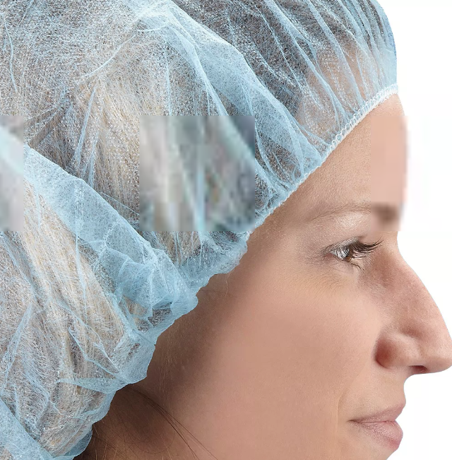 Nurse Caps – RIO Medical Supplies